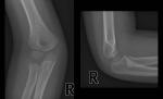 Rx: Normalbefund f 3y 1mo Normal findings f 3y 1mo