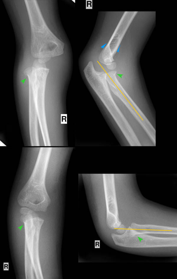 © Institut für Diagnostische, Interventionelle und Pädiatrische ...