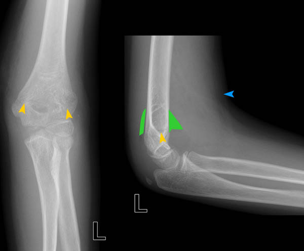 © Institut für Diagnostische, Interventionelle und Pädiatrische ...