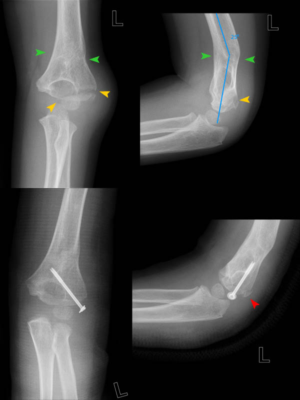 © Institut für Diagnostische, Interventionelle und Pädiatrische ...