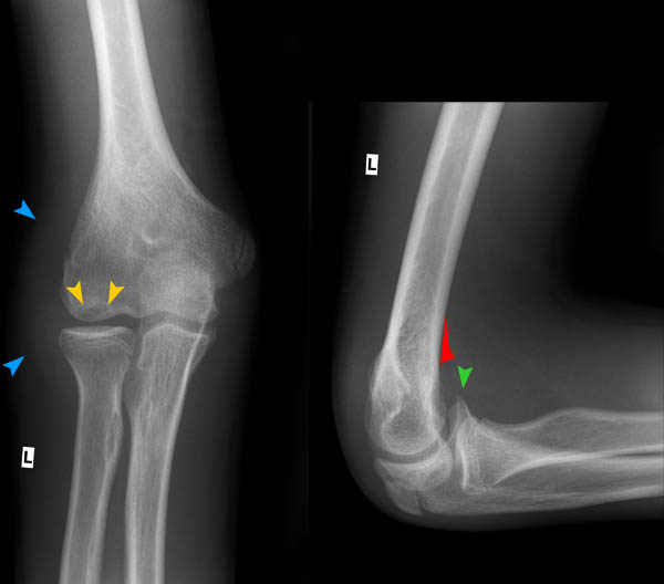 © Institut für Diagnostische, Interventionelle und Pädiatrische ...