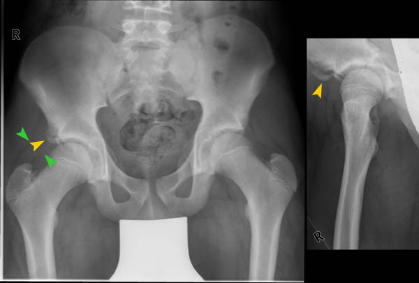 © Institut für Diagnostische, Interventionelle und Pädiatrische ...