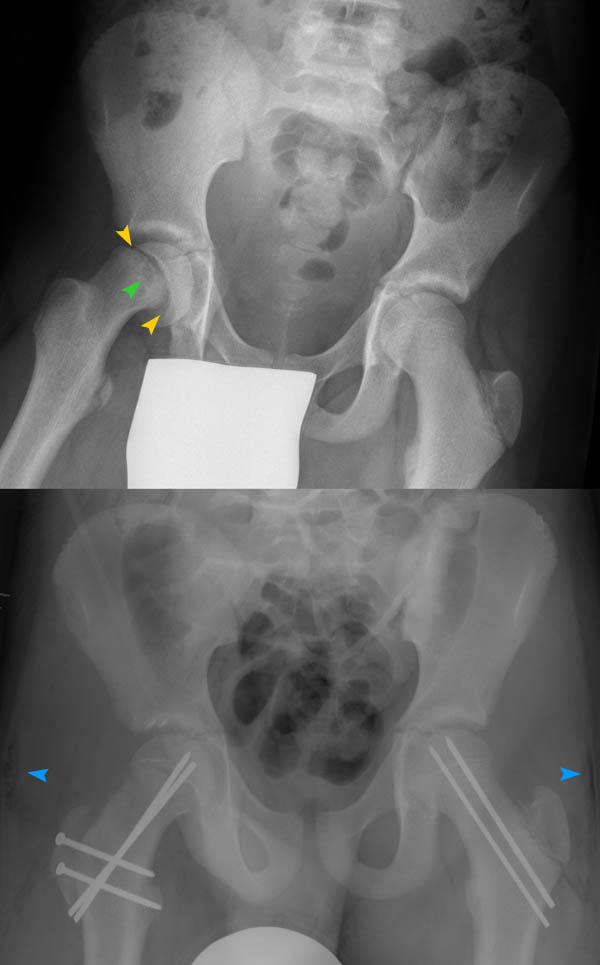 © Institut für Diagnostische, Interventionelle und Pädiatrische ...