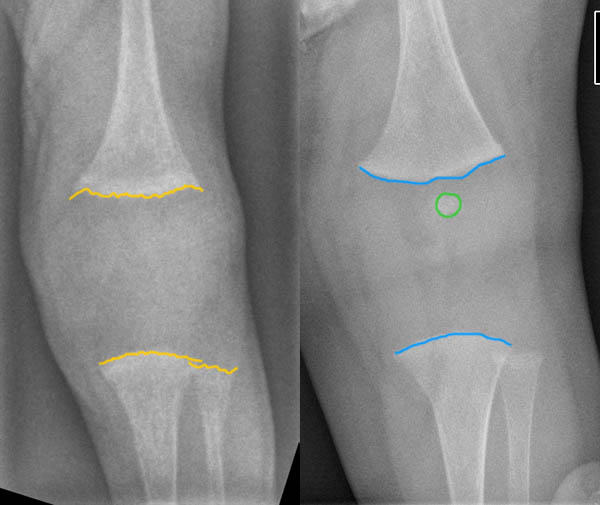 © Institut für Diagnostische, Interventionelle und Pädiatrische ...