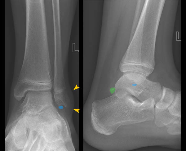 © Institut für Diagnostische, Interventionelle und Pädiatrische ...