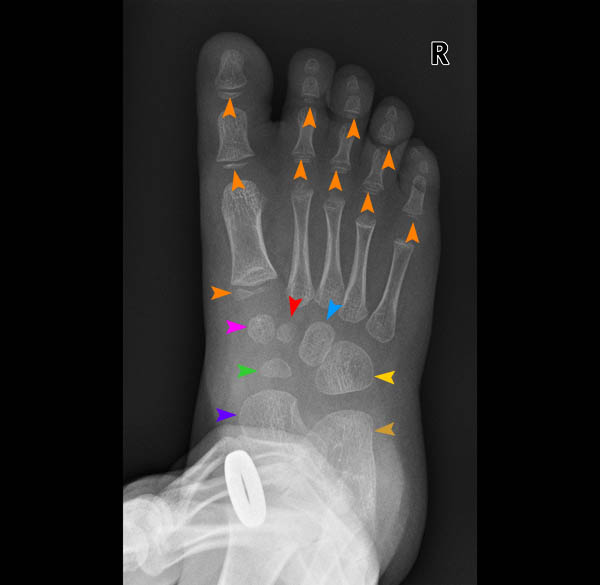© Institut für Diagnostische, Interventionelle und Pädiatrische ...