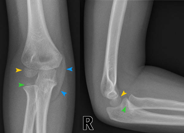 © Institut für Diagnostische, Interventionelle und Pädiatrische ...