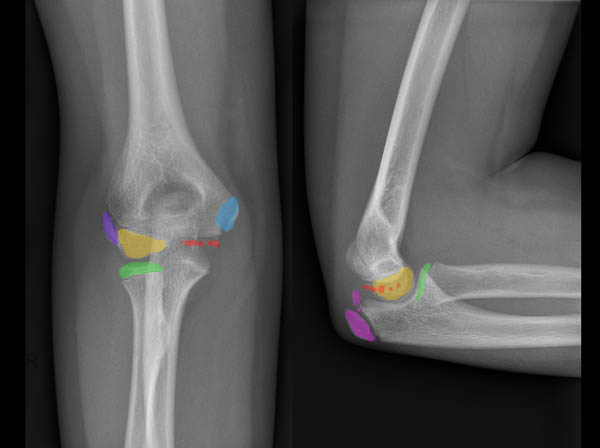 © Institut für Diagnostische, Interventionelle und Pädiatrische Radiologie, Inselspital Bern