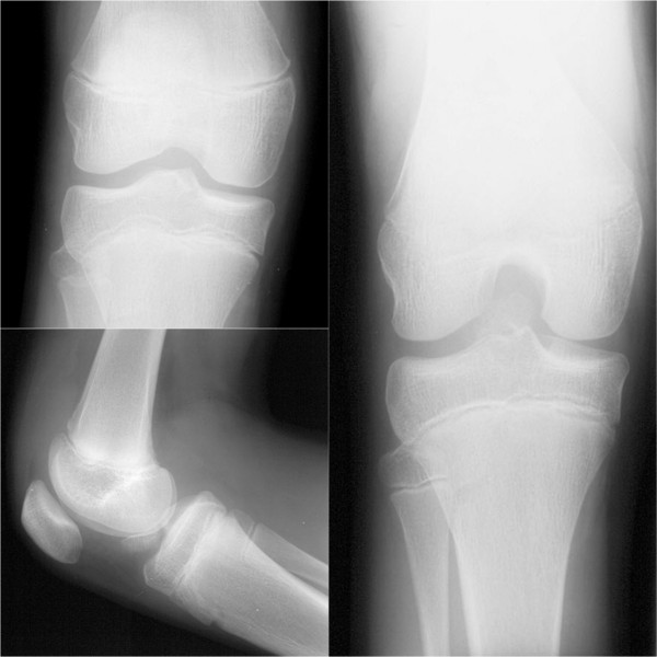 © Institut für Diagnostische, Interventionelle und Pädiatrische ...