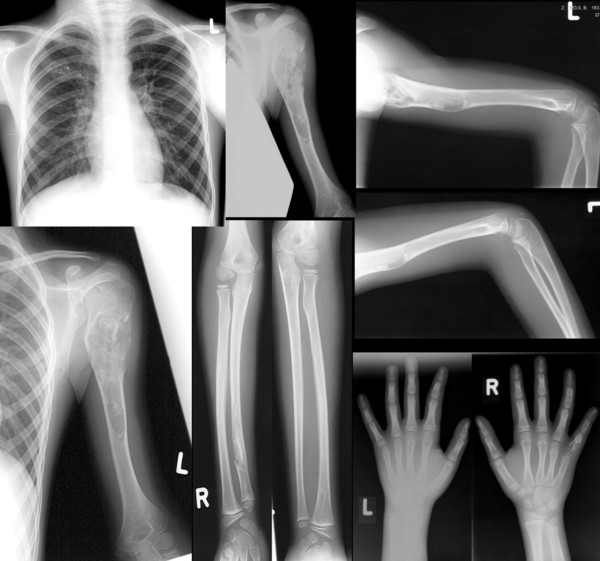 © Institut für Diagnostische, Interventionelle und Pädiatrische ...