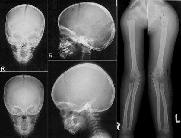 © Institut für Diagnostische, Interventionelle und Pädiatrische ...