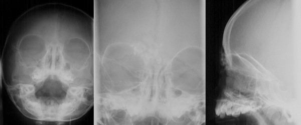 © Institut für Diagnostische, Interventionelle und Pädiatrische ...