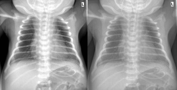 © Institut für Diagnostische, Interventionelle und Pädiatrische ...