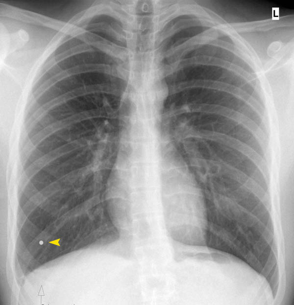 © Institut für Diagnostische, Interventionelle und Pädiatrische ...