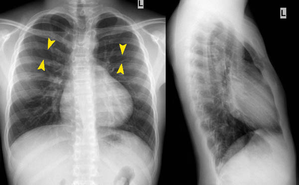 © Institut für Diagnostische, Interventionelle und Pädiatrische ...