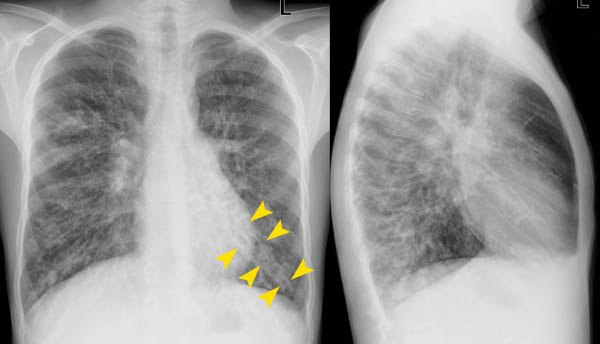 © Institut für Diagnostische, Interventionelle und Pädiatrische ...