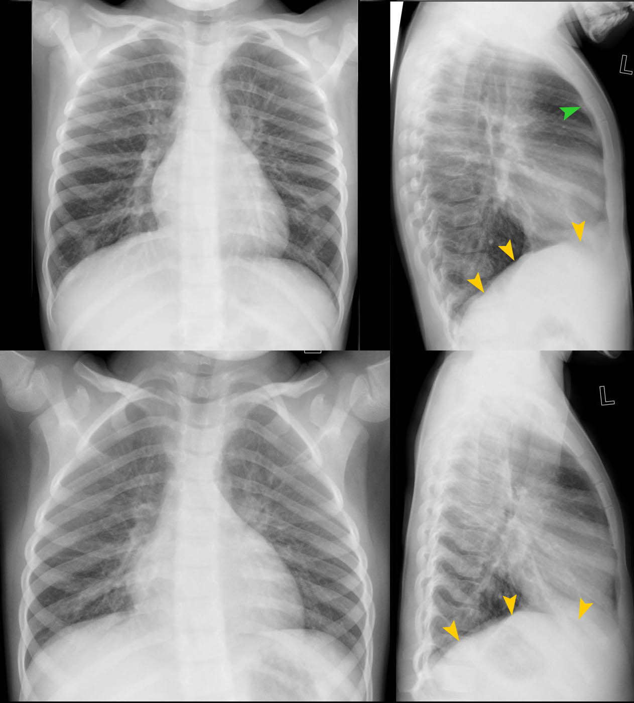 © Institut für Diagnostische, Interventionelle und Pädiatrische ...