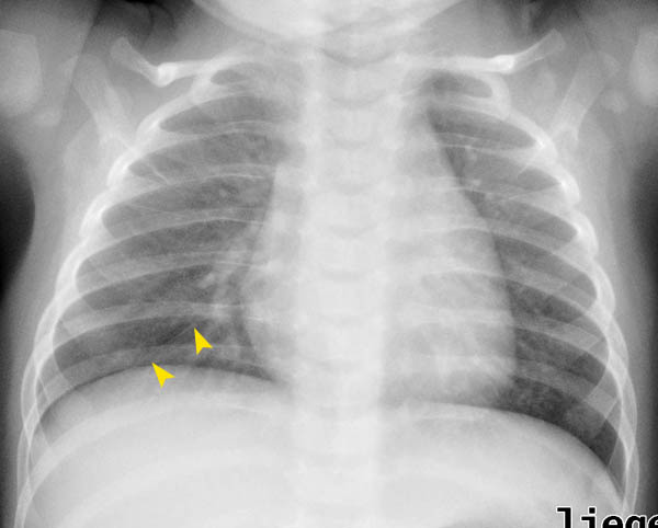 institut für diagnostische interventionelle und pädiatrische radiologie ...