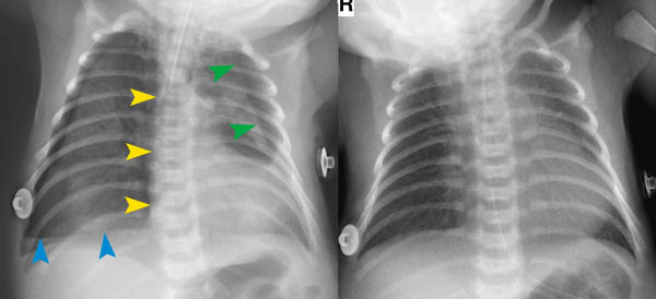 institut für diagnostische interventionelle und pädiatrische radiologie ...