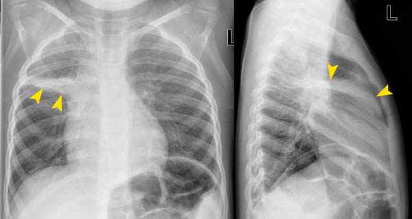 institut für diagnostische interventionelle und pädiatrische radiologie ...