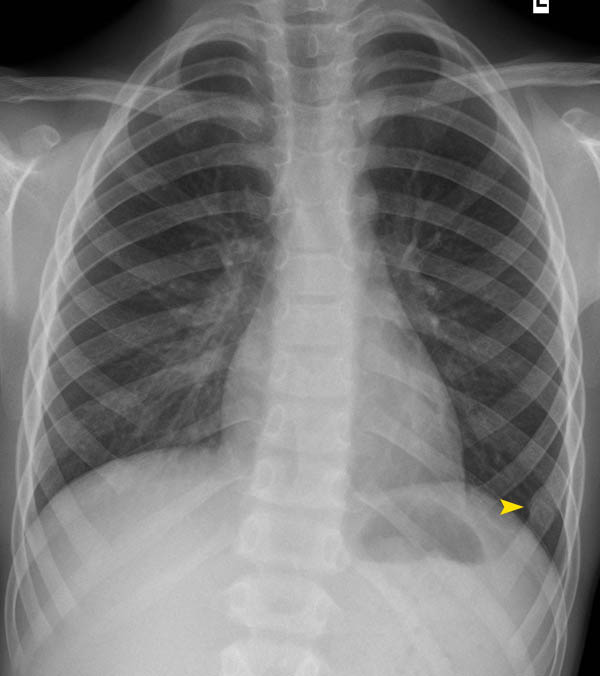 © Institut für Diagnostische, Interventionelle und Pädiatrische ...