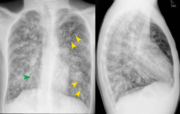 © Institut für Diagnostische, Interventionelle und Pädiatrische ...