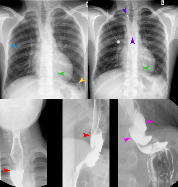 institut für diagnostische interventionelle und pädiatrische radiologie ...